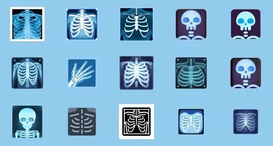 🩻 X-Ray Emoji Copy And Paste - Emoji Stock